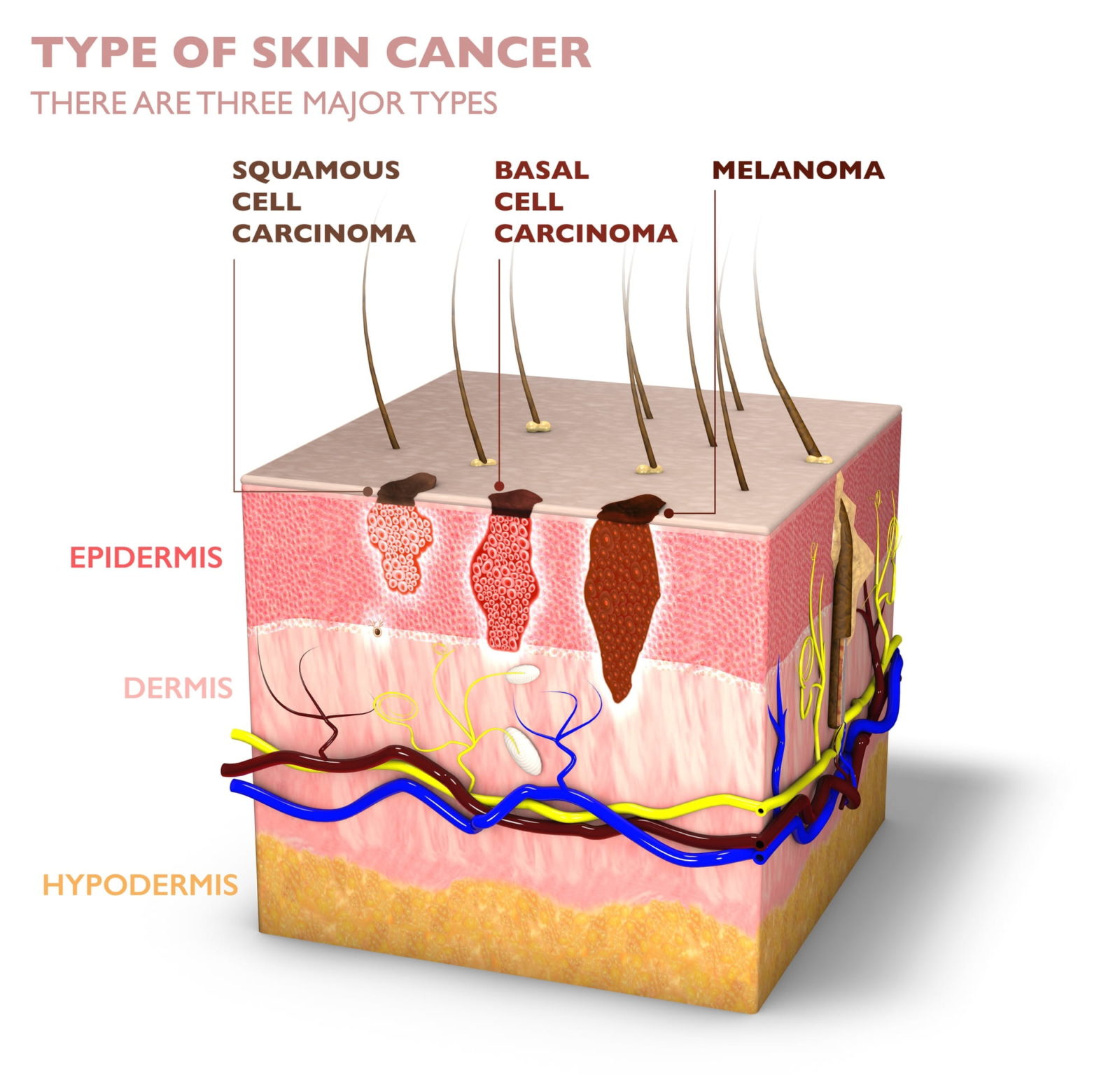 Eczema Treatment by Award-Winning Dermatologists | Glendale
