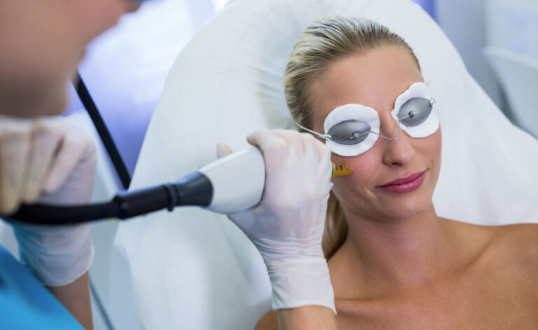 Vbeam Laser Recovery Guide [Do's & Don'ts To Maximize Recovery]