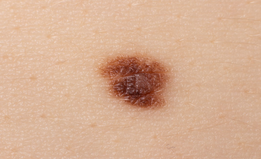 Surgical Dermatology Definitive Guide: Everything You Need To Know