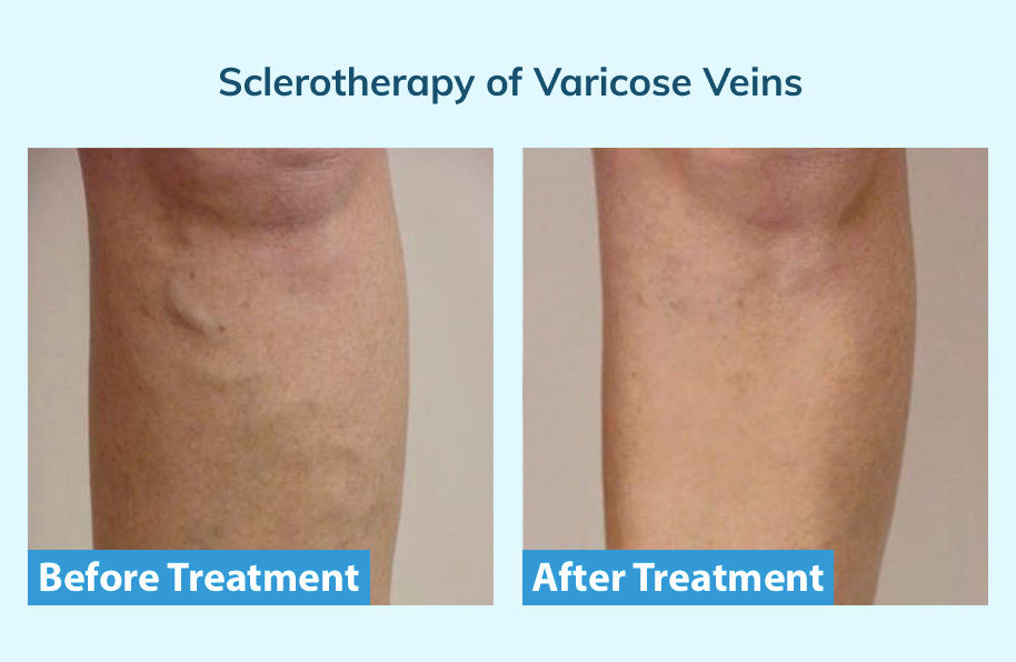 Surgical Dermatology Definitive Guide: Everything You Need To Know