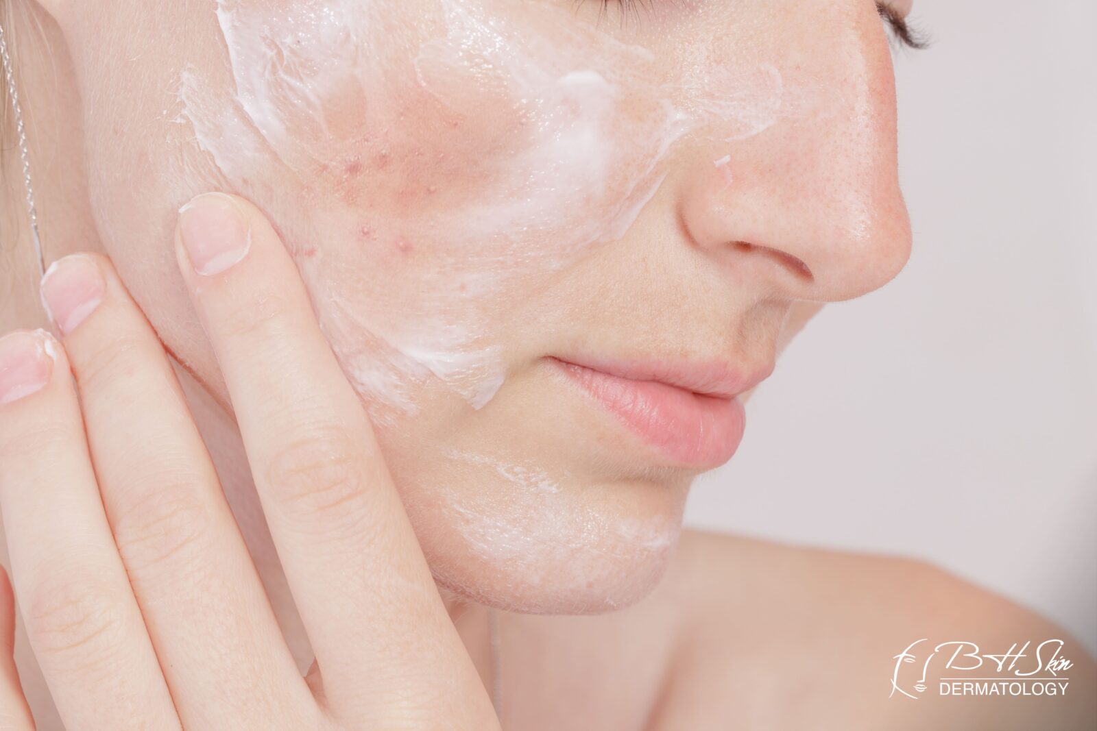 The Best Soaps for Acne: A Dermatologist’s Insight - BHSkin Dermatology